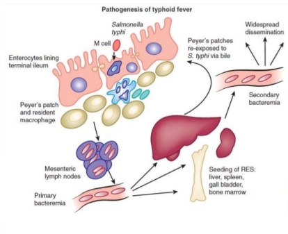 Facts One Must Know About Typhoid… – Dr Renu Madan