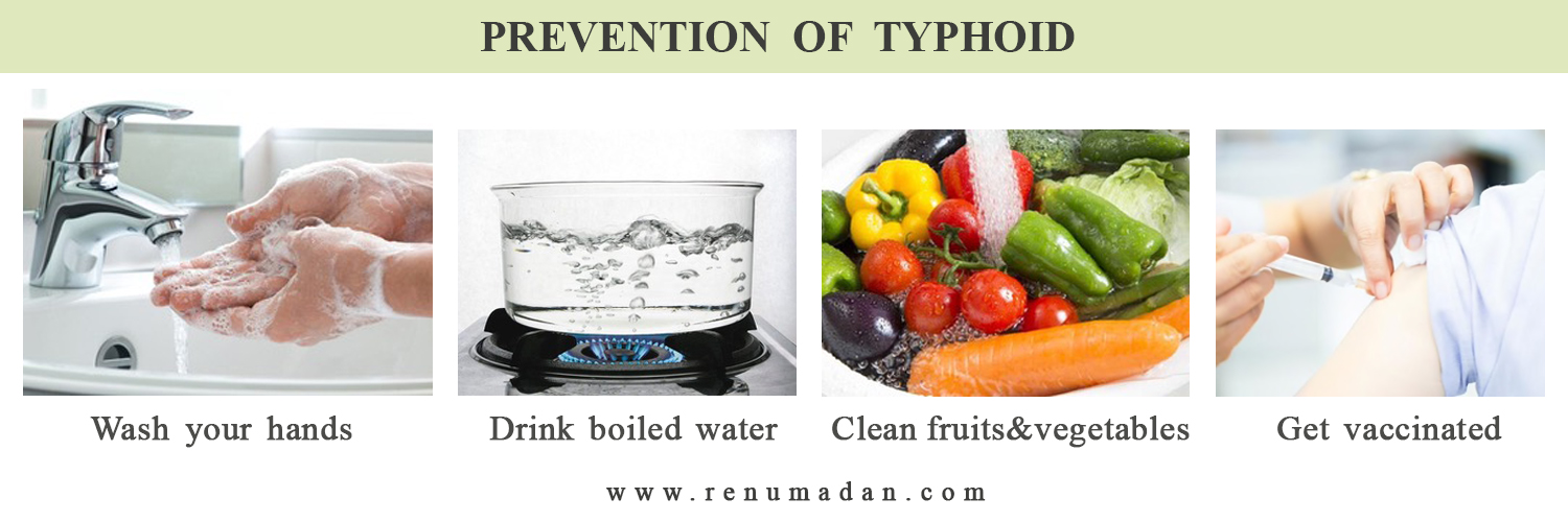 Facts One Must Know About Typhoid… – Dr Renu Madan